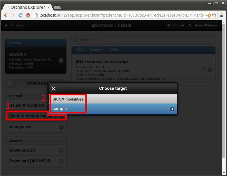 通过Orthanc了解DICOM | alexiusll 的博客